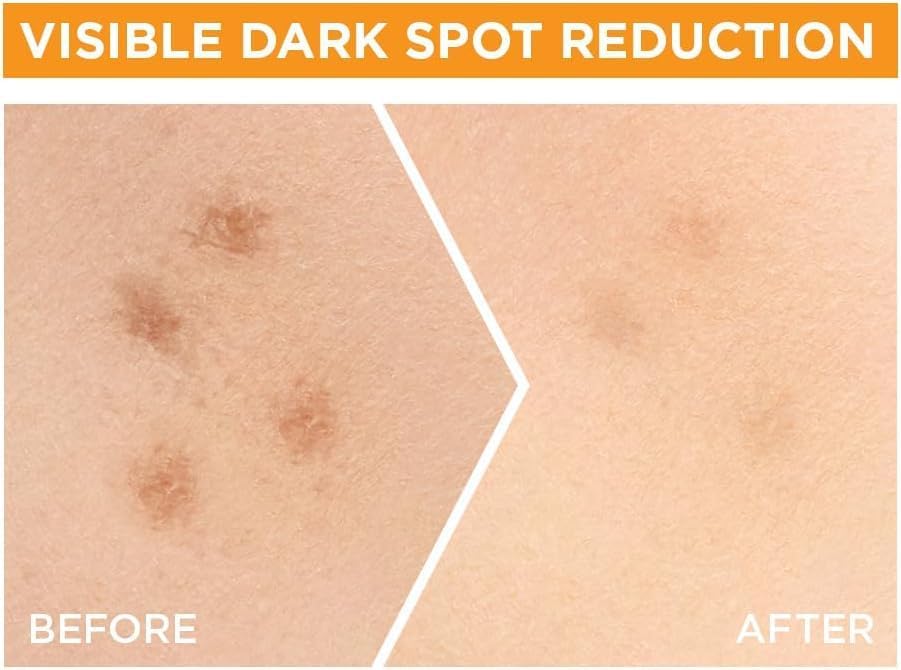 Garnier Fast Bright SkinActive Vitamin C + Niacinamide Anti-Dark Spot ...